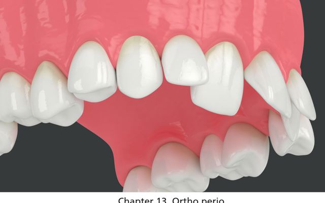Orthodontics and Periodontal Health